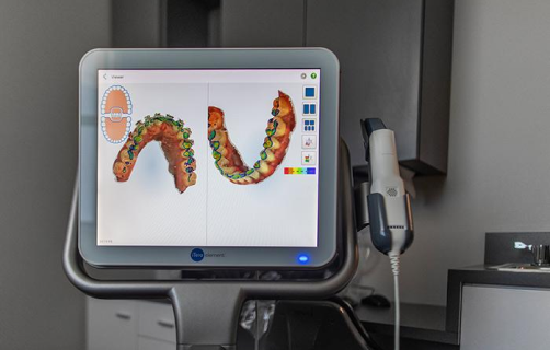Digital Scanning | Orthodontist & Periodontist in La Vista, NE